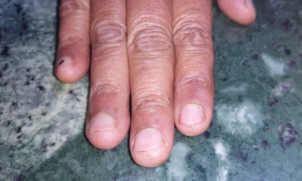 How Long Do Your Natural Fingernails Have To Be To Get A Manicure ...